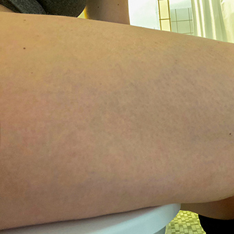 The Solution™ Beauty Collagen - Collagen peptides for your skin